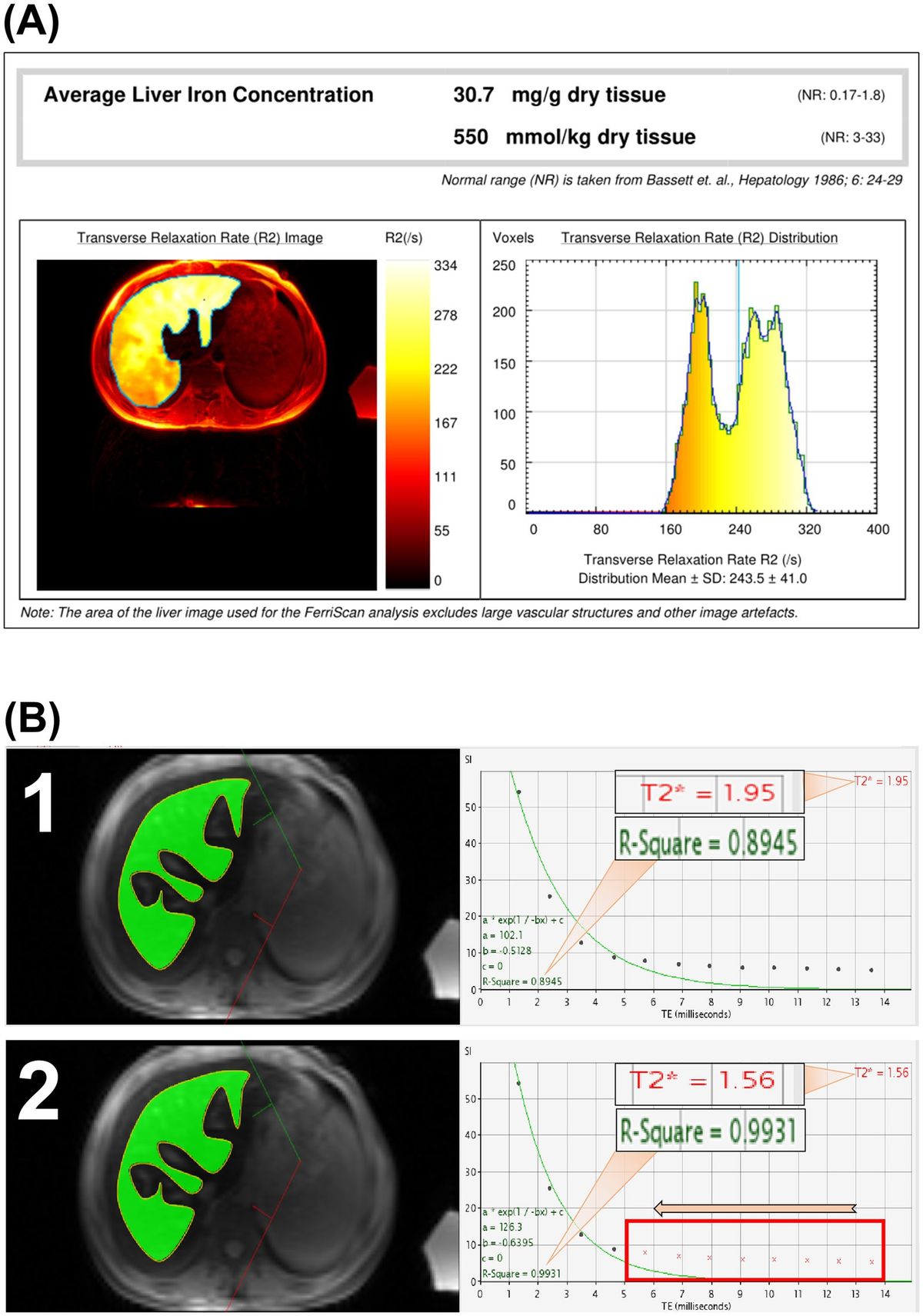 Frontiers | Assessing the accuracy of CMRtools software for diagnosing ...