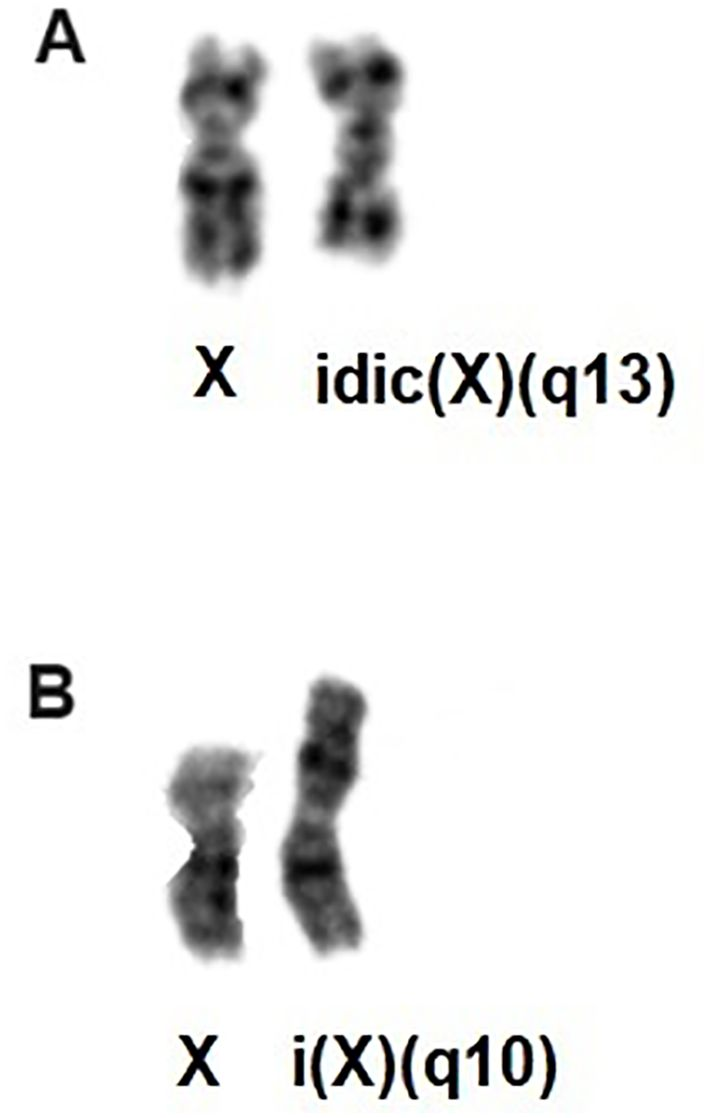 Frontiers | Molecular genetic characterization of myeloid neoplasms with idic(X)(q13) and i(X)(q10)