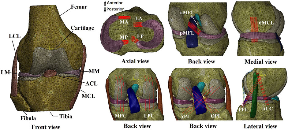 Frontiers | ACL reconstruction combined with anterolateral structures ...