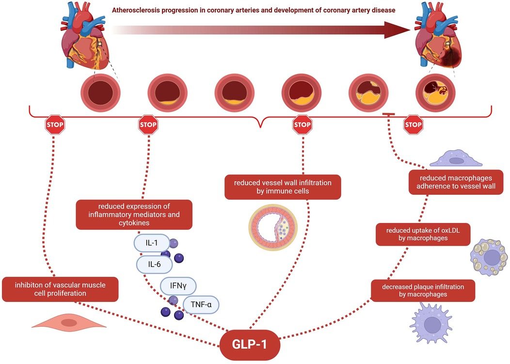 Frontiers | Anti-inflammatory effects of glucagon-like peptide-1 (GLP-1 ...