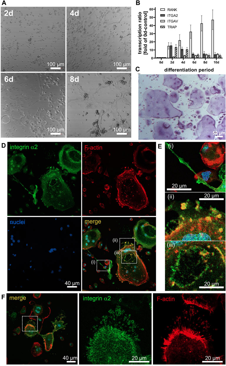 Frontiers | Integrin α2 is an early marker for osteoclast ...