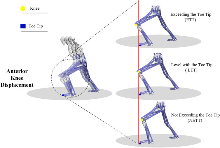 Frontiers | The impact of anterior knee displacement on knee joint load ...