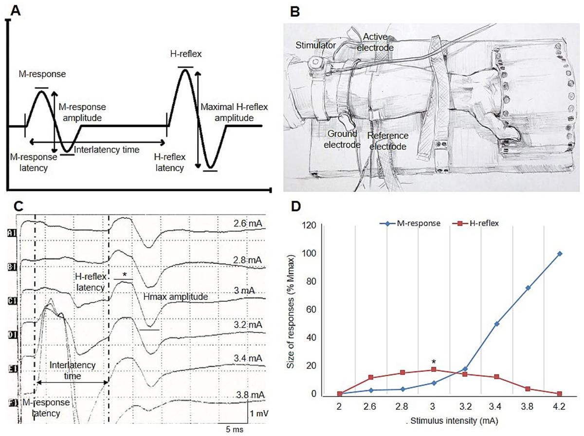 Frontiers | The H-reflex study of the flexor carpi radialis muscle in ...