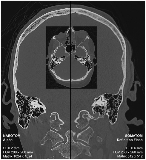Frontiers | Photon-counting CT for forensic death investigations—a ...