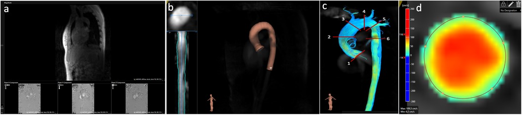 Frontiers | The influence of post-processing software on quantitative ...