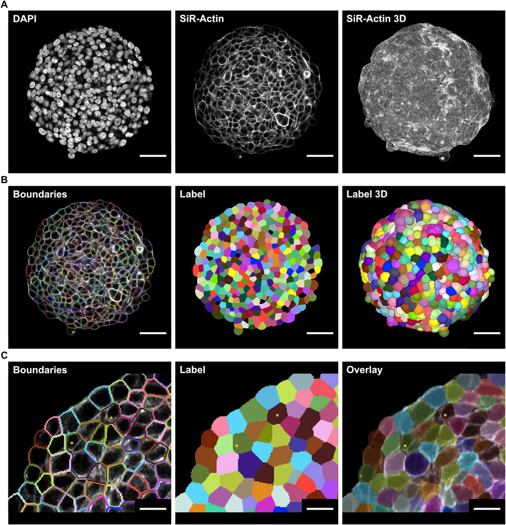 Frontiers | From in vitro to in silico: a pipeline for generating virtual tissue simulations ...
