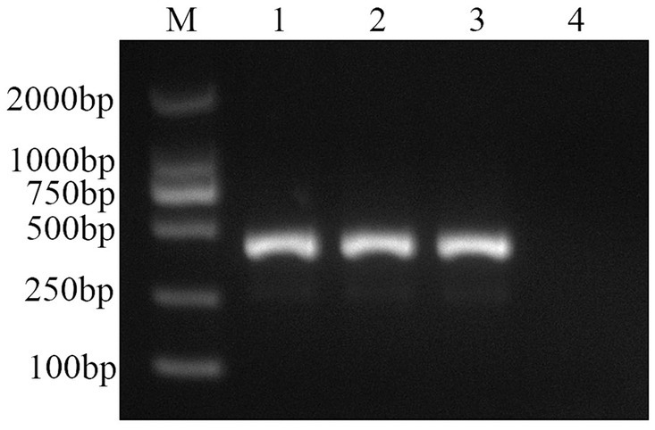 Frontiers | Development and application of a quantitative real-time PCR method for detection of ...
