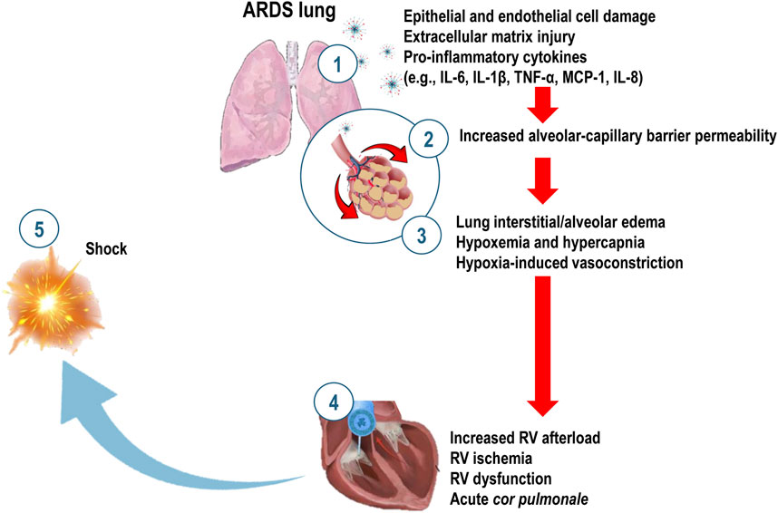 Frontiers | Heart-lung crosstalk in acute respiratory distress syndrome