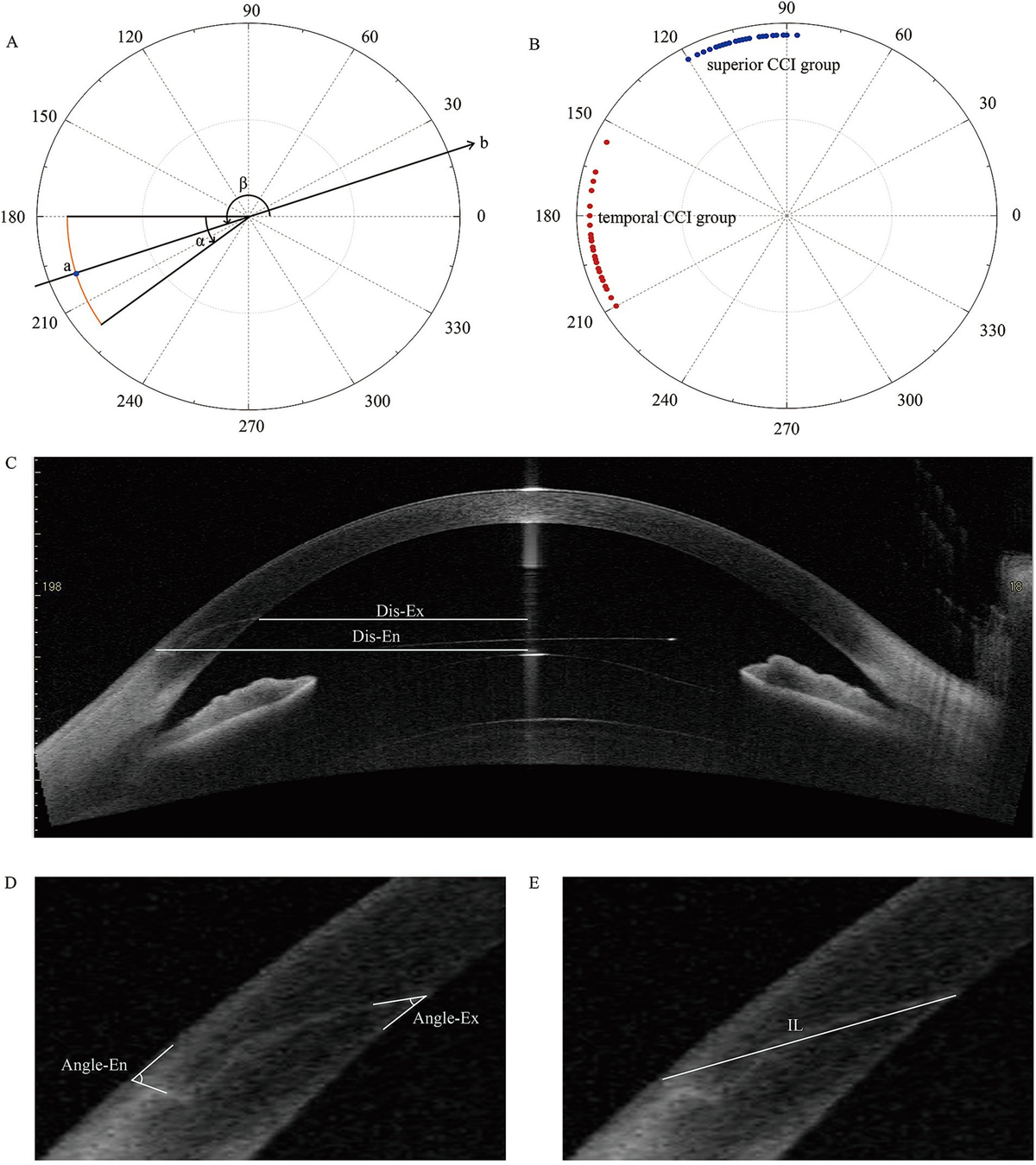 Frontiers | Effects of clear corneal incision location and morphology ...