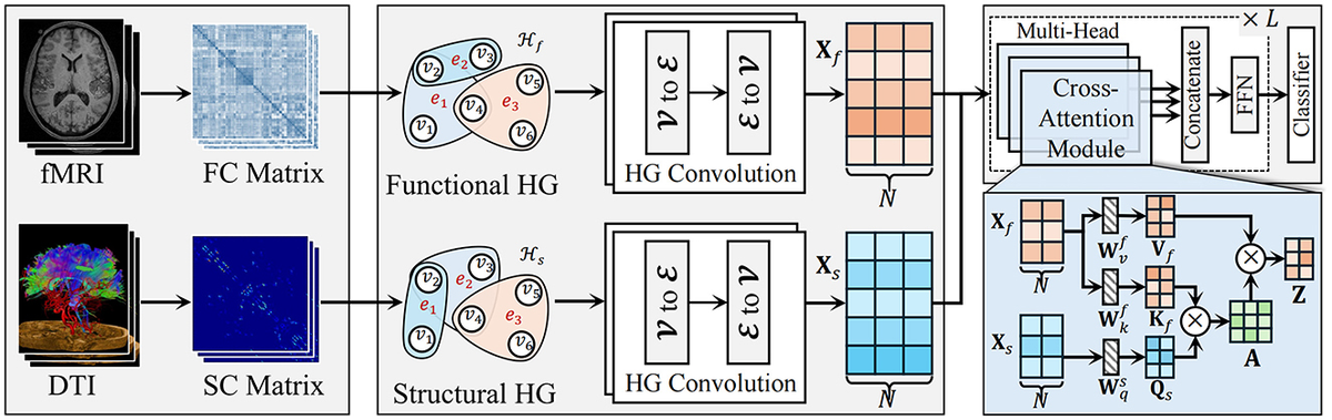 Frontiers | A hypergraph transformer method for brain disease diagnosis