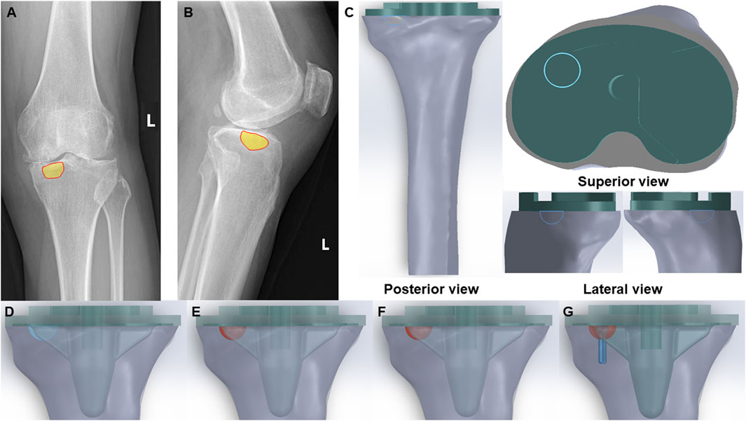 Frontiers | Biomechanical analysis of different techniques for residual ...