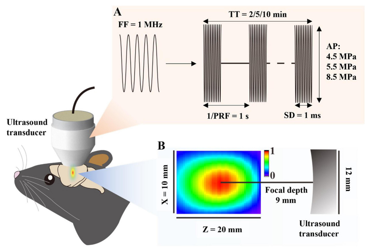 Frontiers | The effect of combined ultrasound stimulation and gastrodin ...
