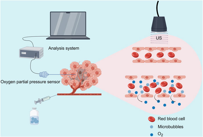 Frontiers | Effect of ultrasound combined with microbubbles therapy on ...