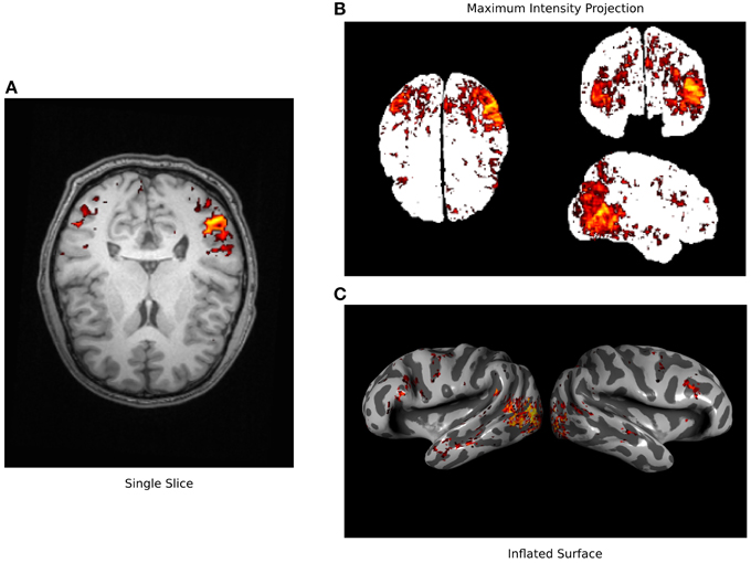 Frontiers | Pycortex: an interactive surface visualizer for fMRI