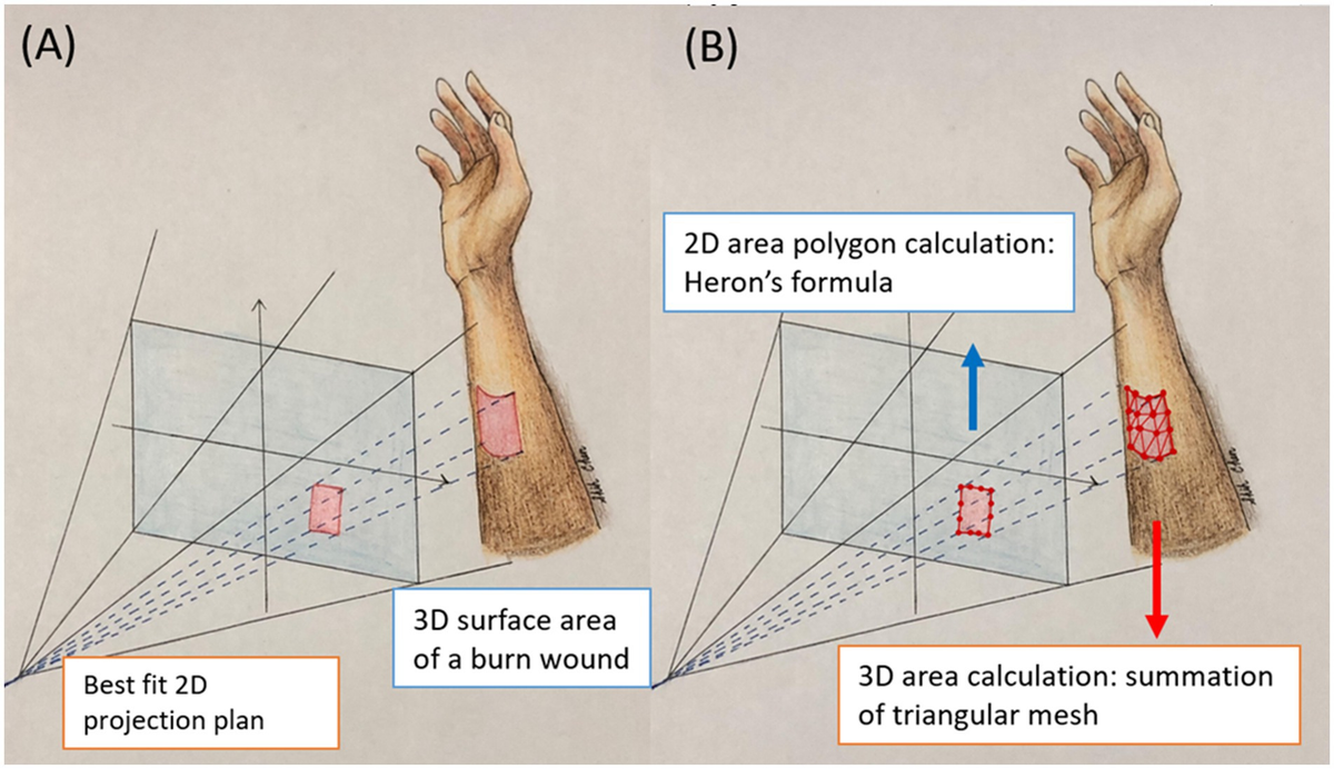 Frontiers | Comparison of 3D and 2D area measurement of acute burn ...