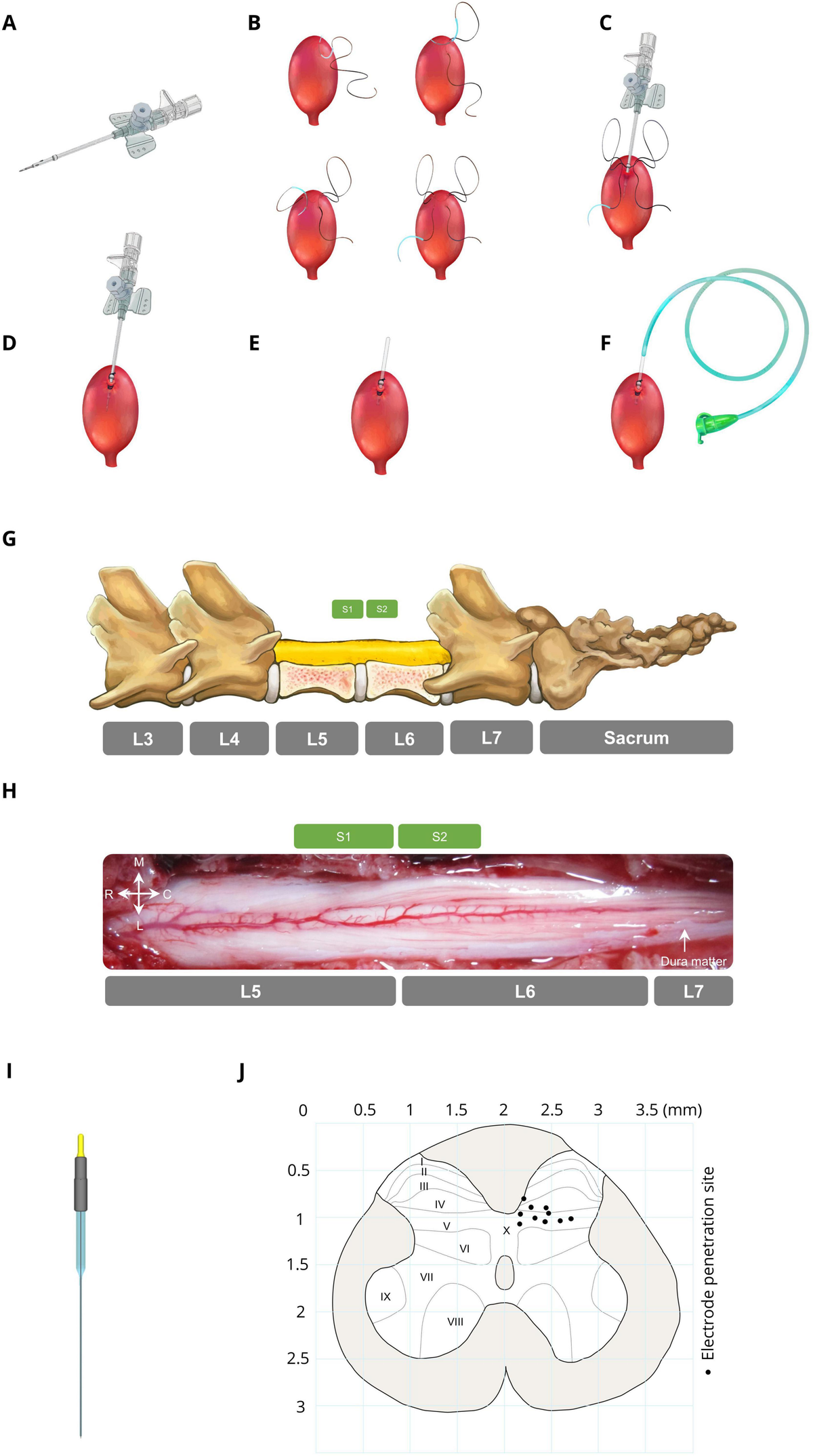 Frontiers | The inhibitory effect of intraspinal microstimulation of ...