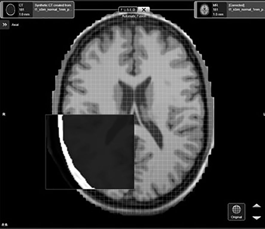 Frontiers | Virtual phantom methodology for assessment of MRI distortion correction in high ...