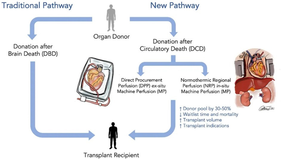 Frontiers | Cardiac preservation using ex vivo organ perfusion: new ...