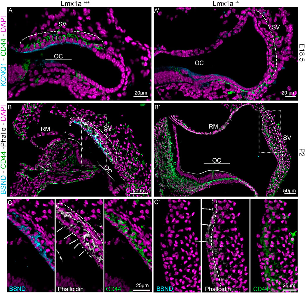Frontiers | Lmx1a is essential for marginal cell differentiation and ...