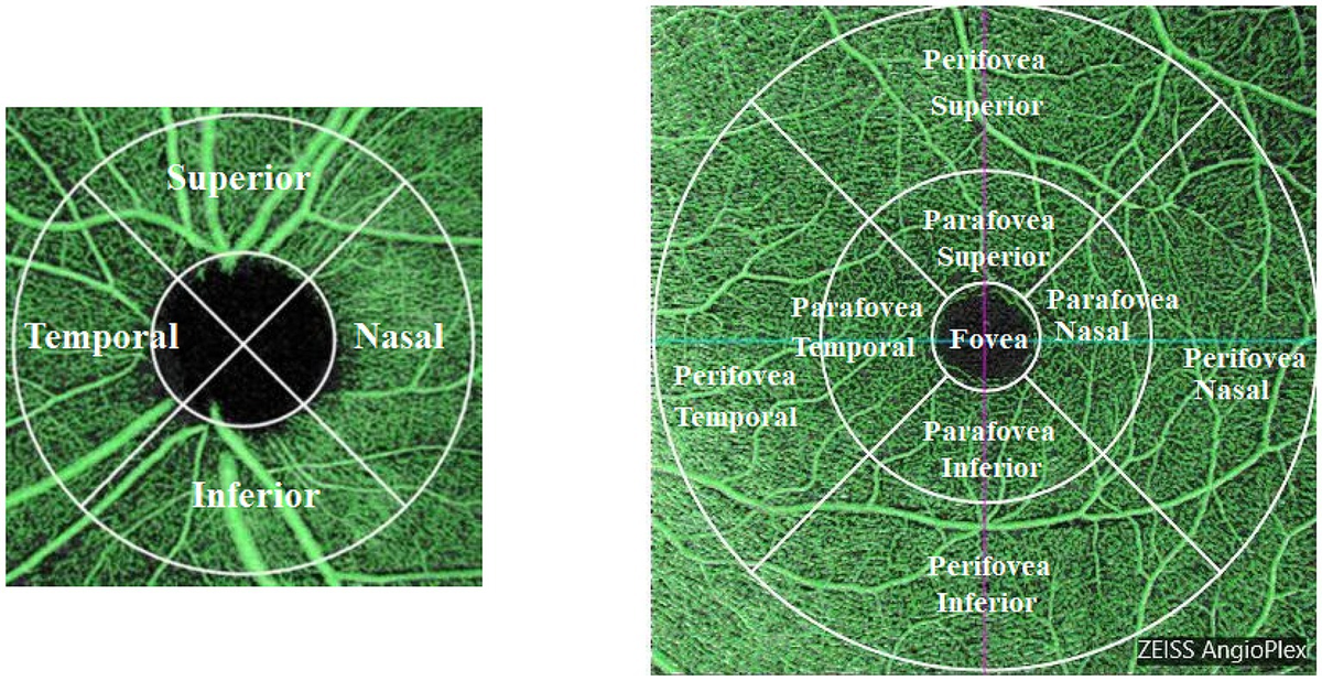 Frontiers | The strong correlation between visual function improvement ...