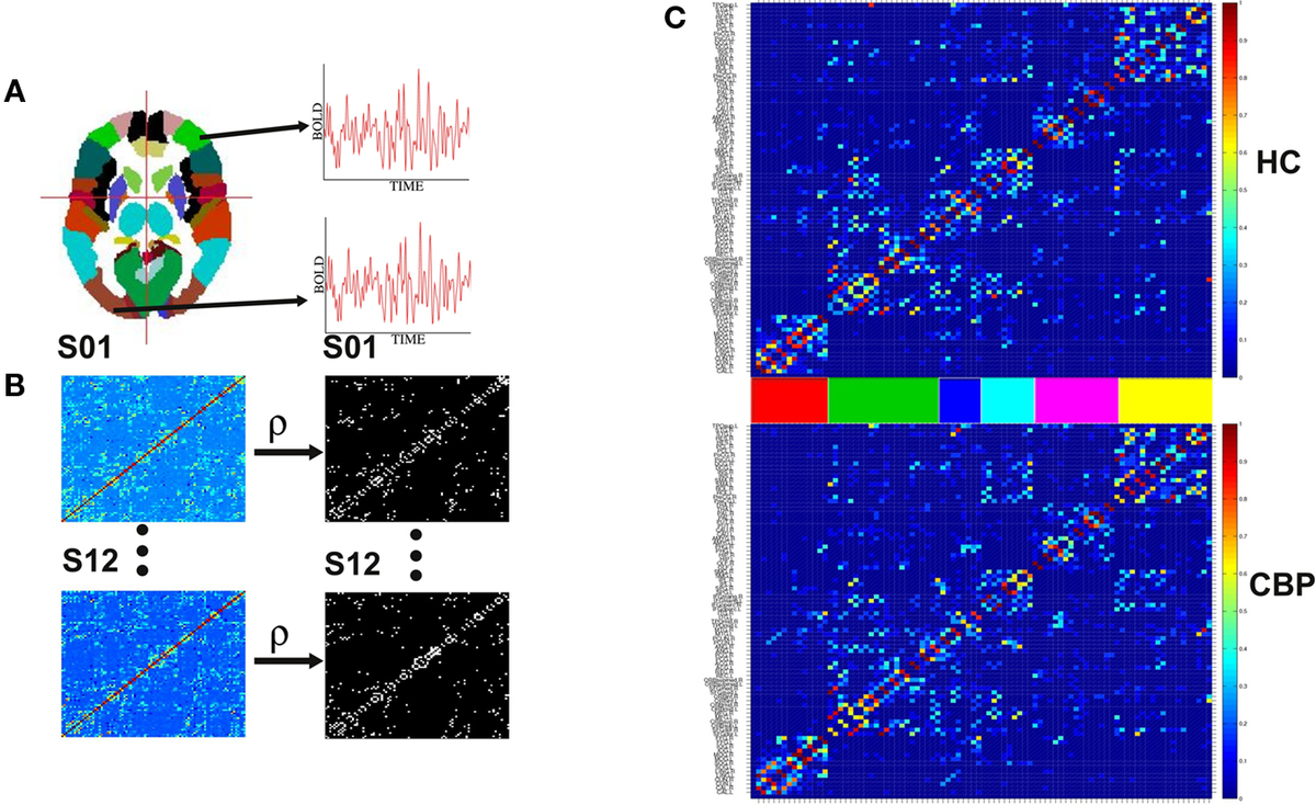 Frontiers | Modular Organization of Brain Resting State Networks in Chronic Back Pain Patients