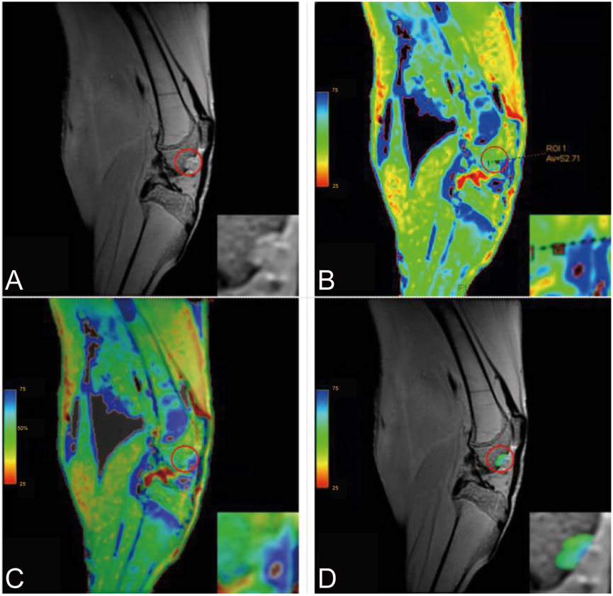 Frontiers | MRI monitoring of USPIO-labeled BMSCs combined with ...