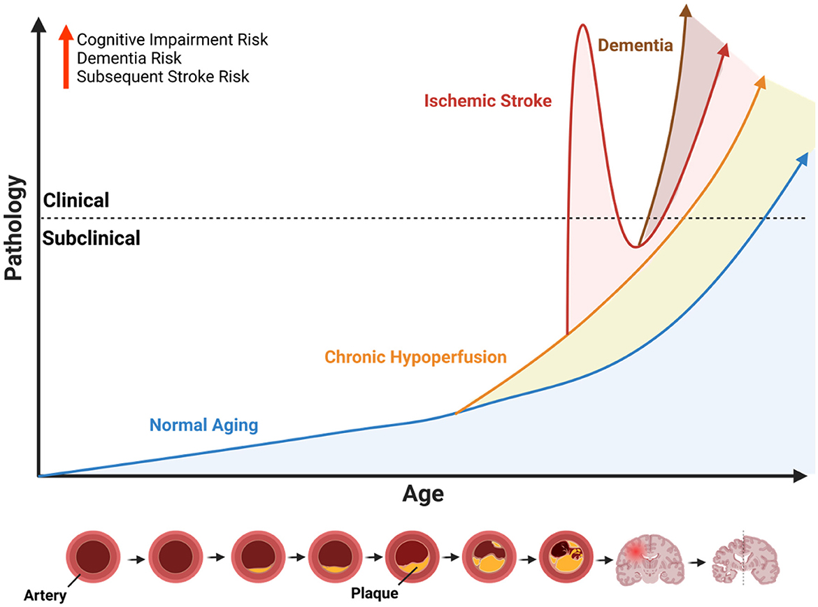Frontiers | Models and mechanisms of post-stroke dementia and cognitive ...