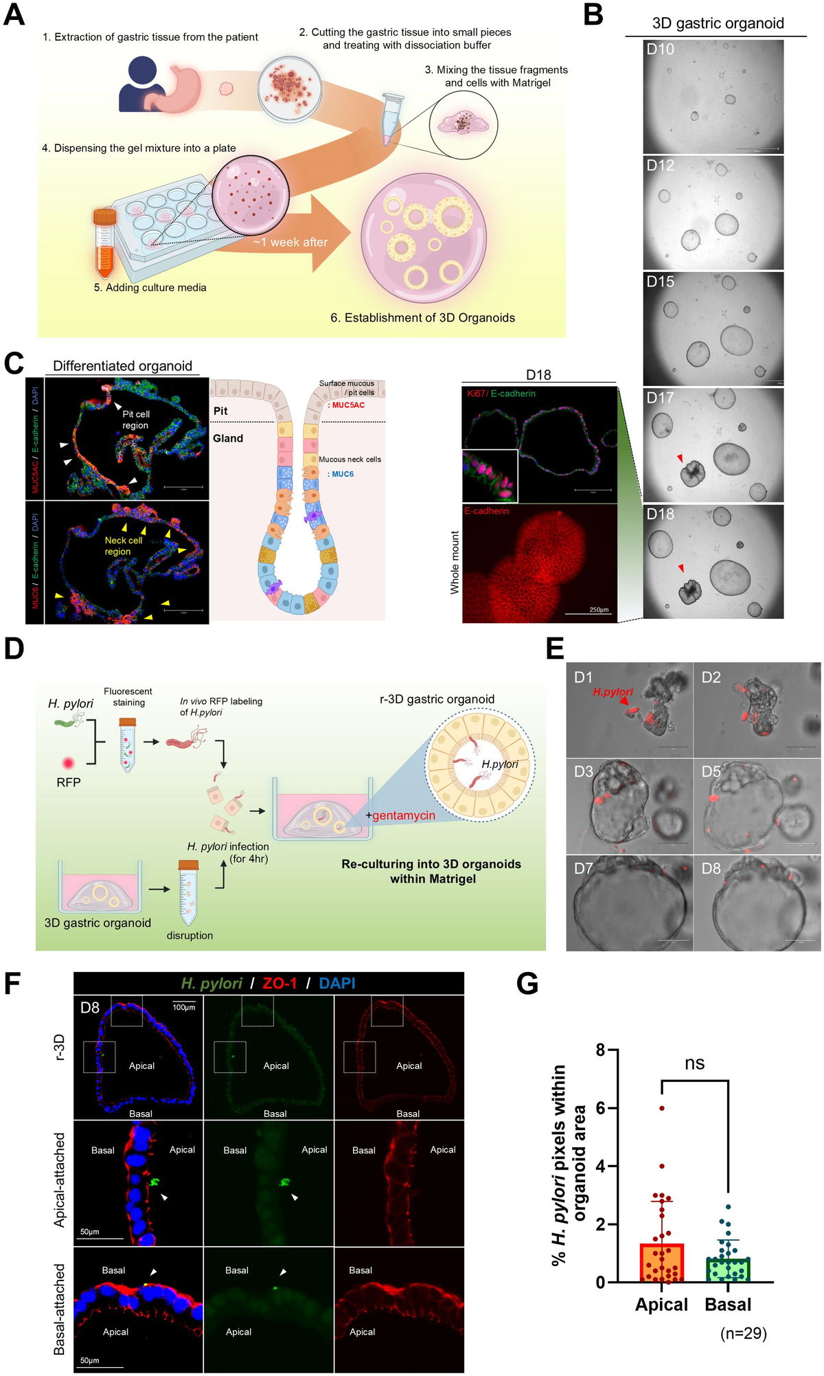 Frontiers | Application of an organoid-based model to explore ...