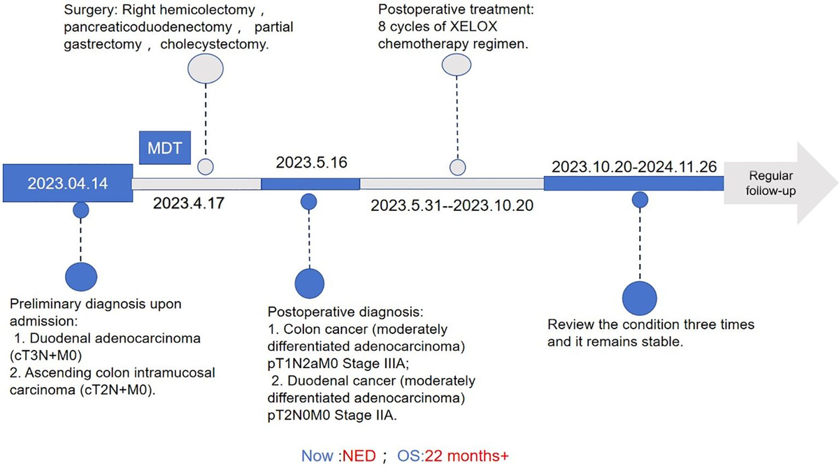 Frontiers | Simultaneous double primary malignant tumors of MSS/pMMR ...