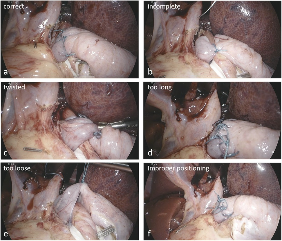 Frontiers | Artificial intelligence based surgical support for ...