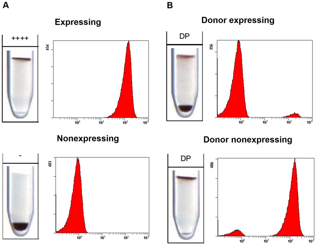 Frontiers | Gel card kit to detect recent homologous blood transfusion ...