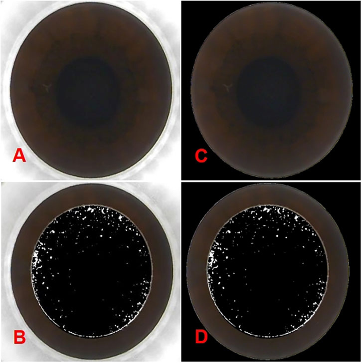 Frontiers | Based on TransRes-Pix2Pix network to generate the OBL image ...