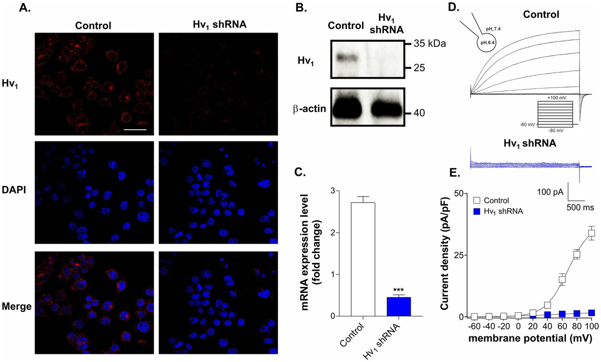 Frontiers | Validation of Hv1 channel functions in BV2 microglial cells ...