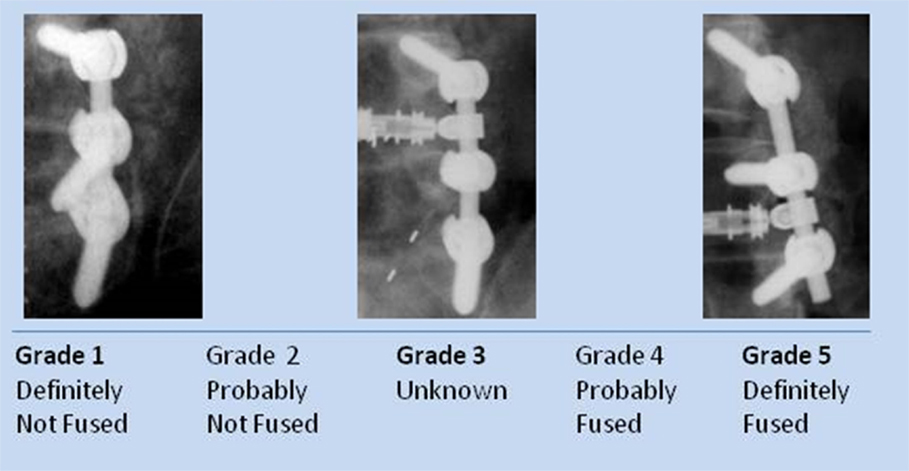 Frontiers | Within Patient Radiological Comparative Analysis of the ...