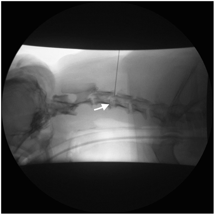 Frontiers | Perineural Injection for Treatment of Root-Signature Signs ...