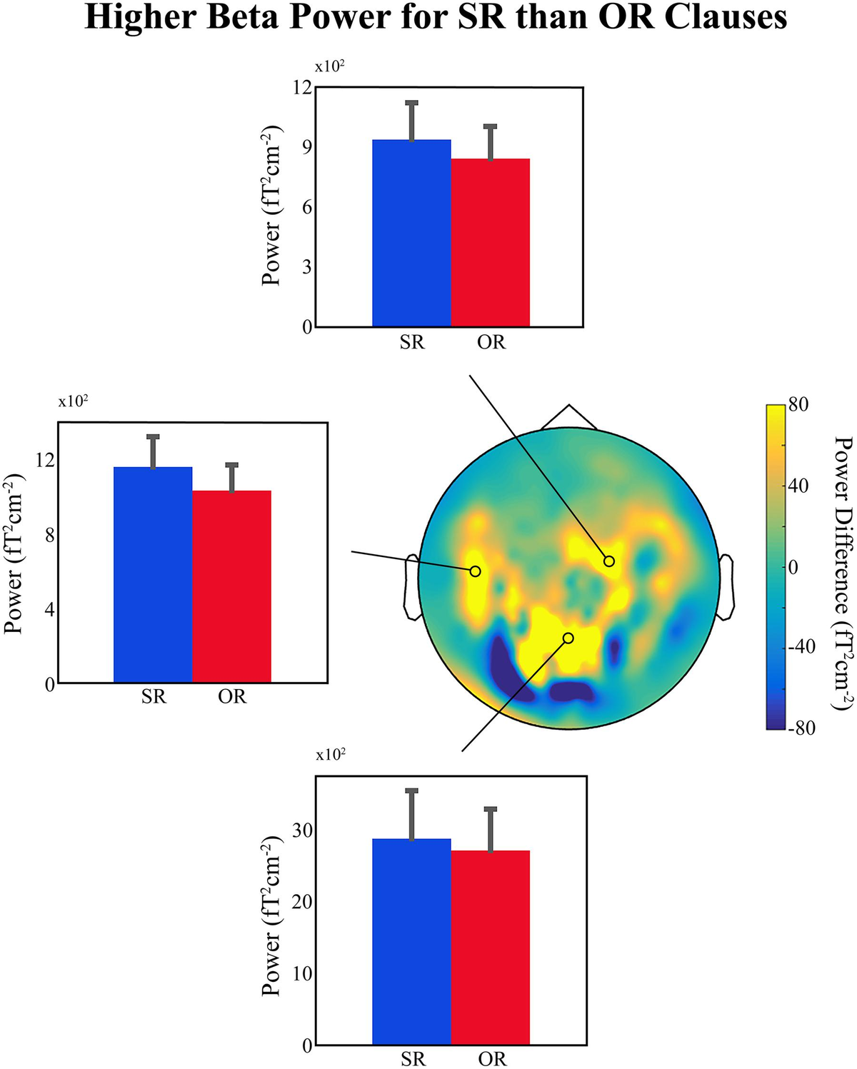 Frontiers | A Predictive Coding Perspective on Beta Oscillations during ...