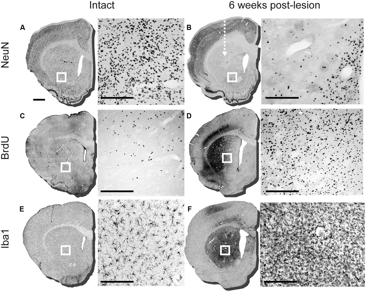 Frontiers | Over-Expression of Meteorin Drives Gliogenesis Following ...