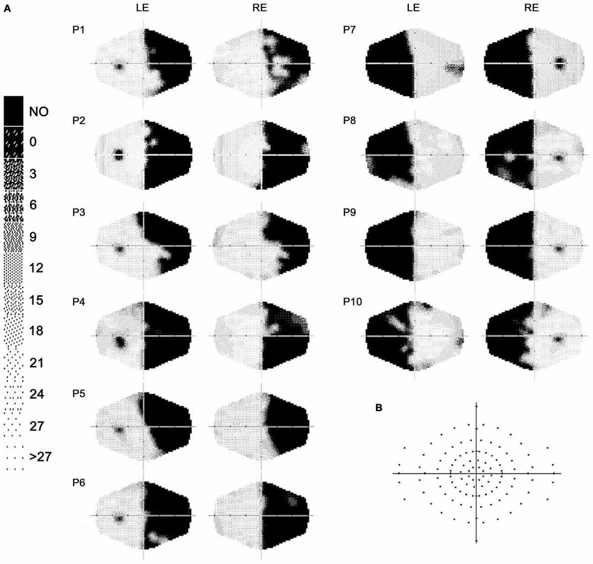 Frontiers | Compensatory Recovery after Multisensory Stimulation in ...