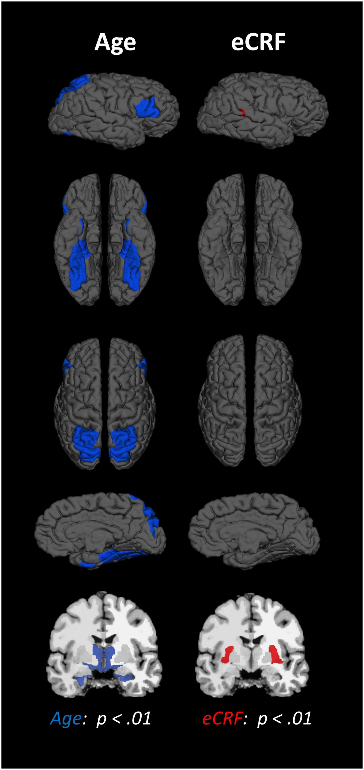 Frontiers | Comparing Aging and Fitness Effects on Brain Anatomy
