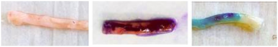 Frontiers | Standard Surgical Skin Markers Should Be Avoided for ...