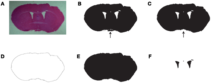 Frontiers | Facilitated Assessment of Tissue Loss Following Traumatic ...