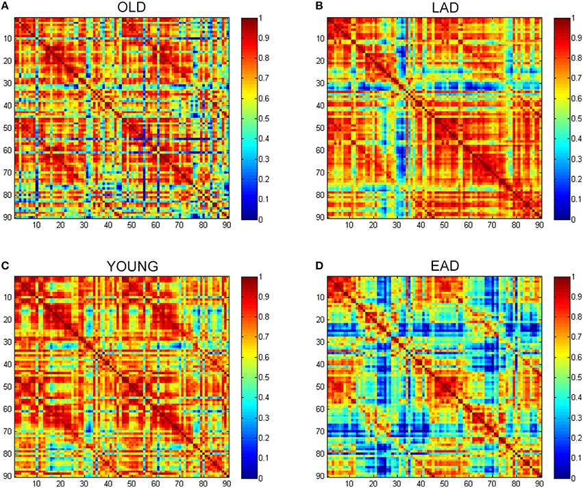Frontiers | Glucose Metabolic Brain Networks in Early-Onset vs. Late ...