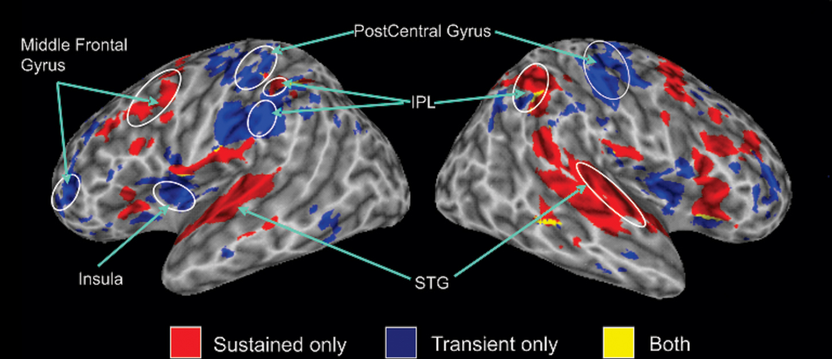 Frontiers | Dissociable Memory- and Response-Related Activity in ...