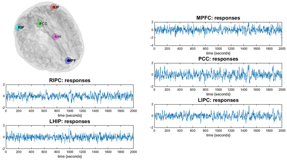Frontiers | Dynamic Causal Modeling of Hippocampal Links within the Human Default Mode Network ...