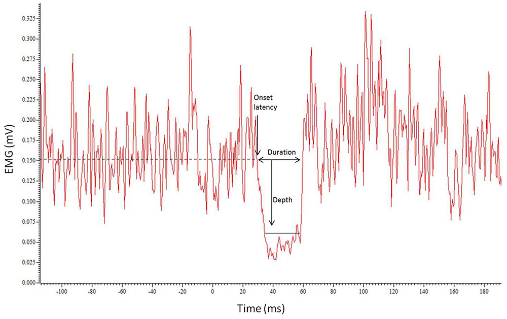 Frontiers | Reliability of Transcallosal Inhibition in Healthy Adults