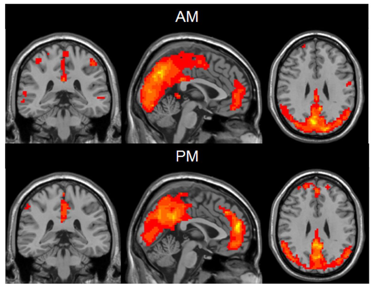 Frontiers | Diurnal Variations in Neural Activity of Healthy Human ...