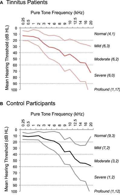 Frontiers | Cortico-limbic morphology separates tinnitus from tinnitus ...