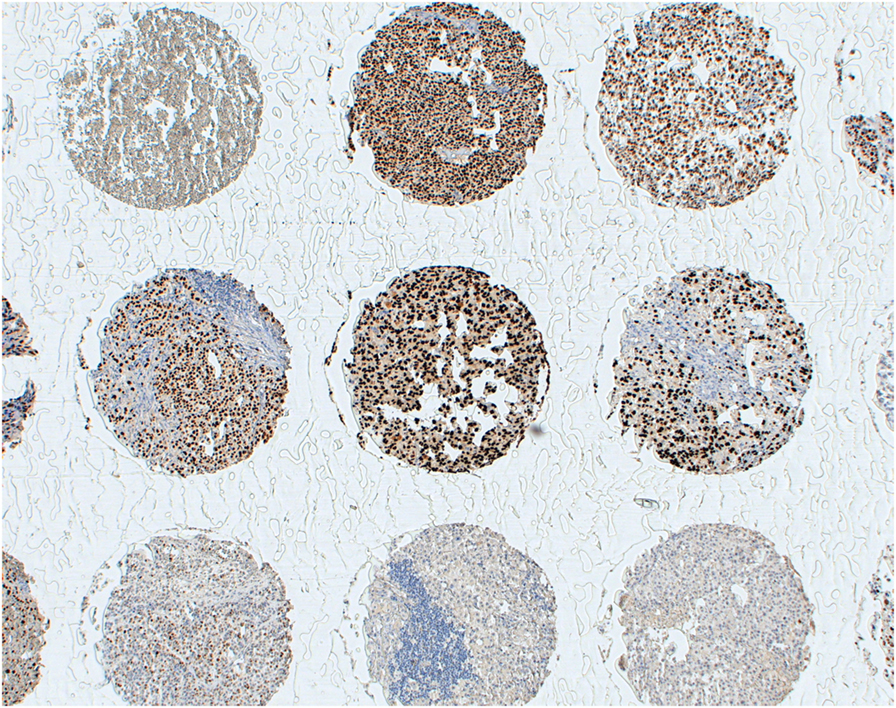 Frontiers | MAGE-A Antigens and Cancer Immunotherapy