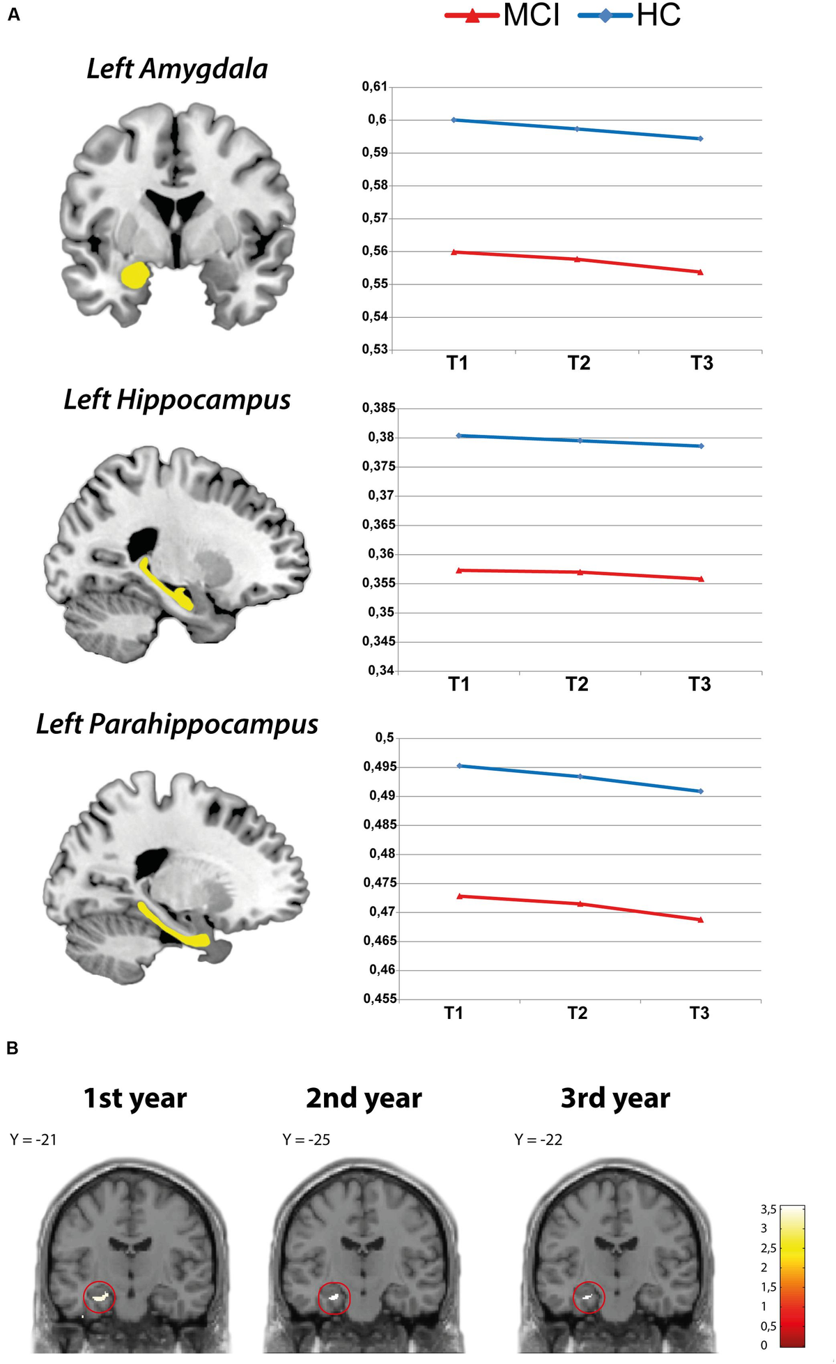 Frontiers | Neuroanatomical and Neuropsychological Markers of Amnestic ...