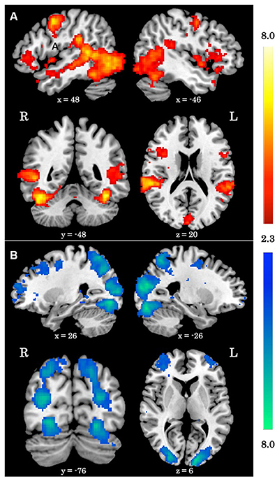 Frontiers | Neural Response to Biological Motion in Healthy Adults ...